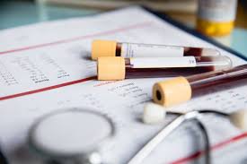 Complete Blood Count (CBC) with Differential and Platelets Blood ...